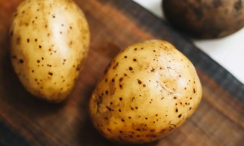 Kitchen Remedies: Potatoes